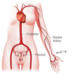 IR Center - AAUrology